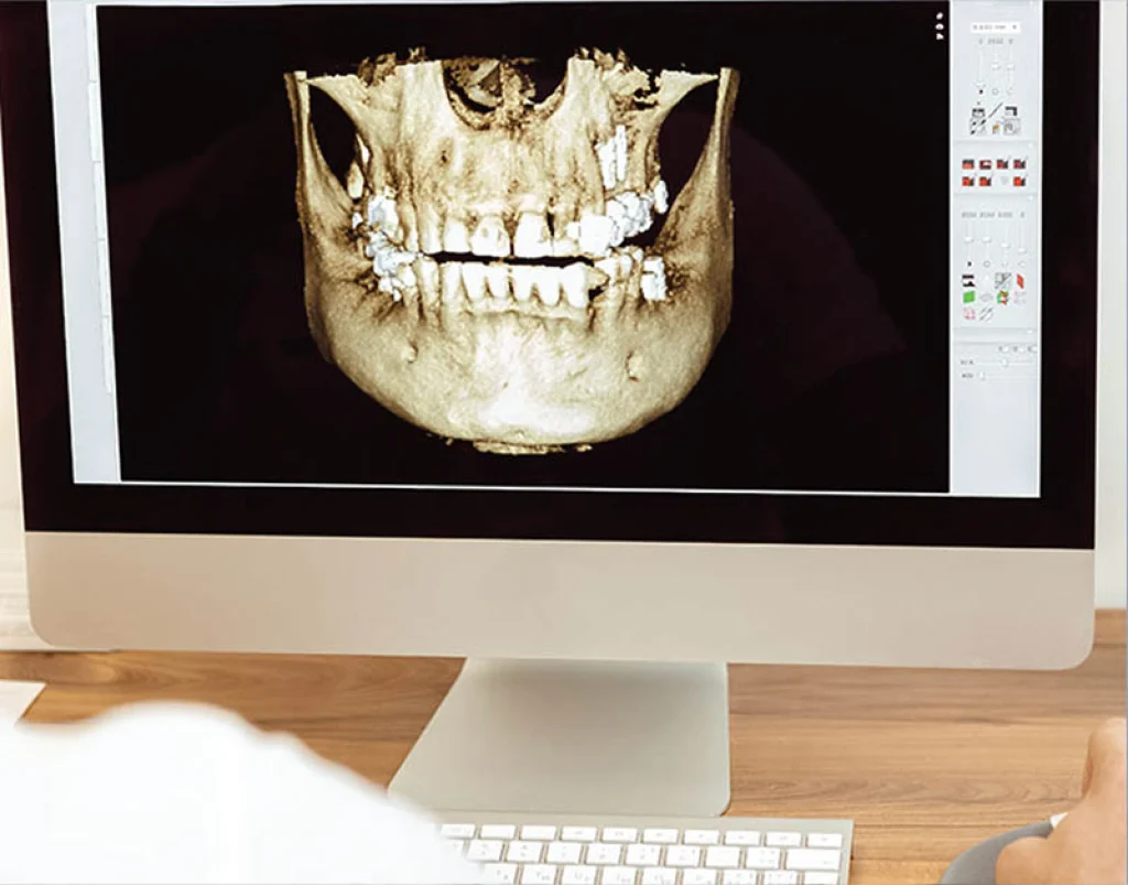 Cone Beam Technology in Austin, TX - Advanced Dental Imaging - Austin ...